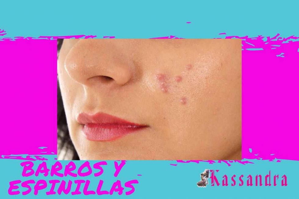 Barros y espinillas - Kassandra Fashion